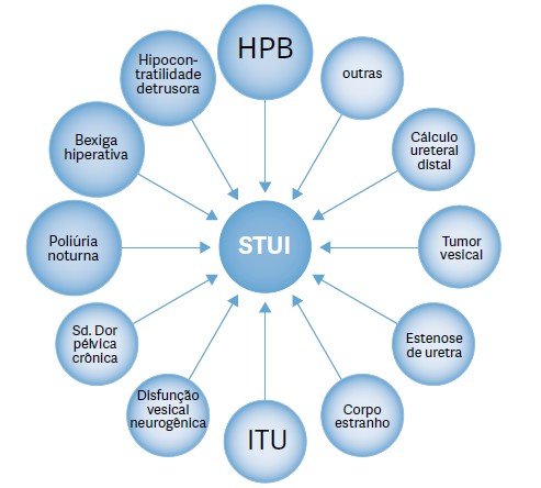 HIPERPLASIA PROSTÁTICA BENIGNA (HPB) / “LUTS” - Dr. Fernando Zapparoli